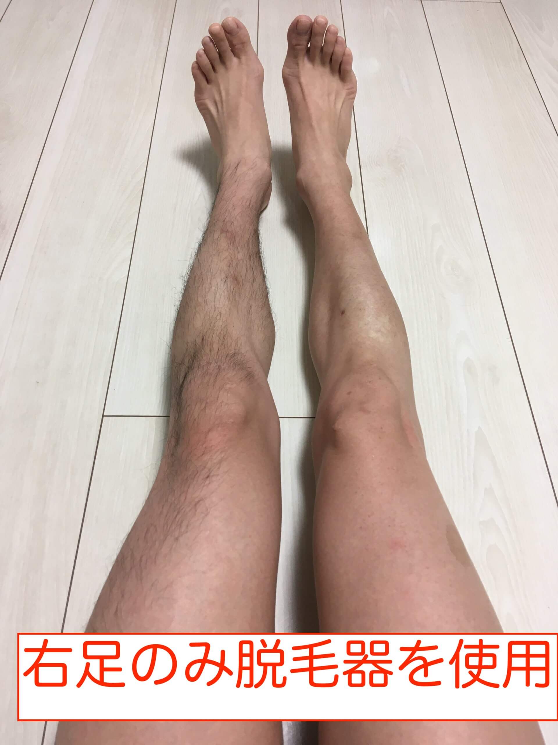 Ulikeの脱毛器はどこの国でどんな会社？買ったので調べてみた！ | ひろこみゅ